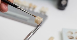 The Problems Associated With Replacing Old or Broken Crowns And How You ...